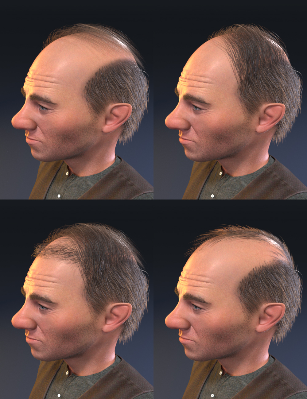 Barnabus Ragwort Balding Hair Collection | Daz 3D