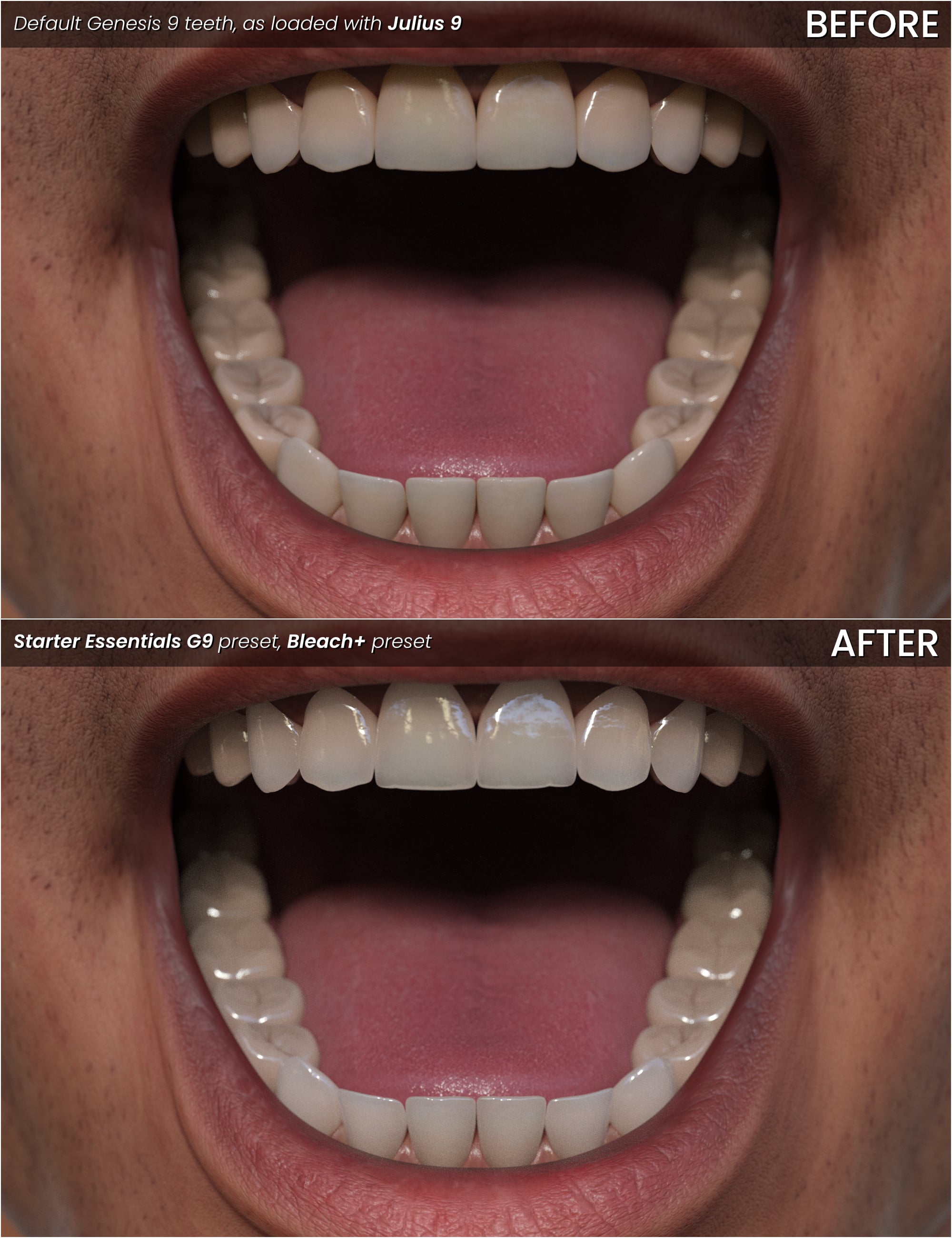 Pearly Whites Teeth Materials ⋆ Freebies Daz 3D
