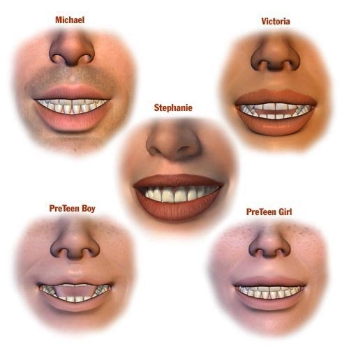 Millennium Teeth | Daz 3D