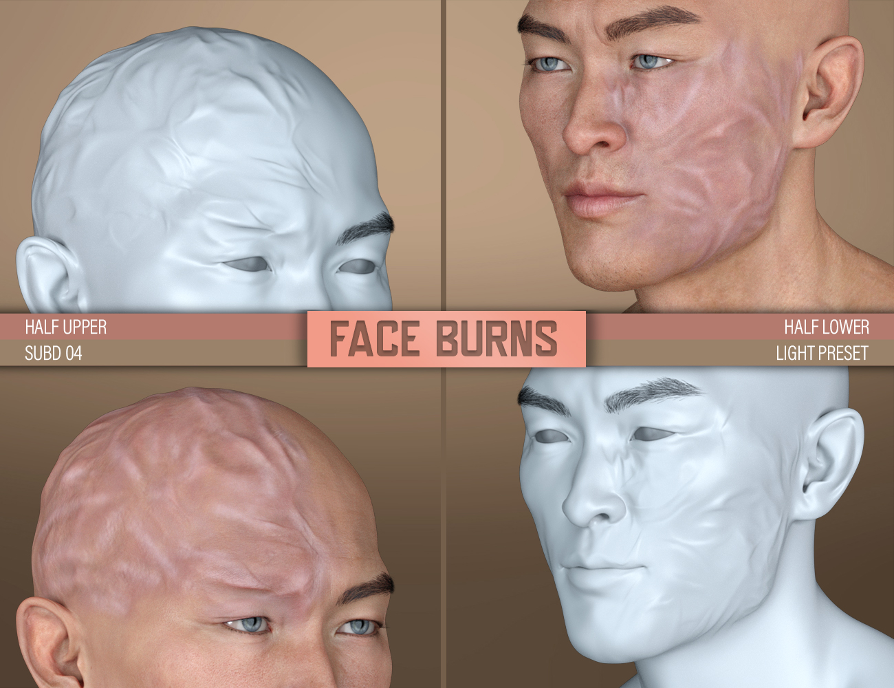 HD Face Burns for Genesis 8 Males | Daz 3D