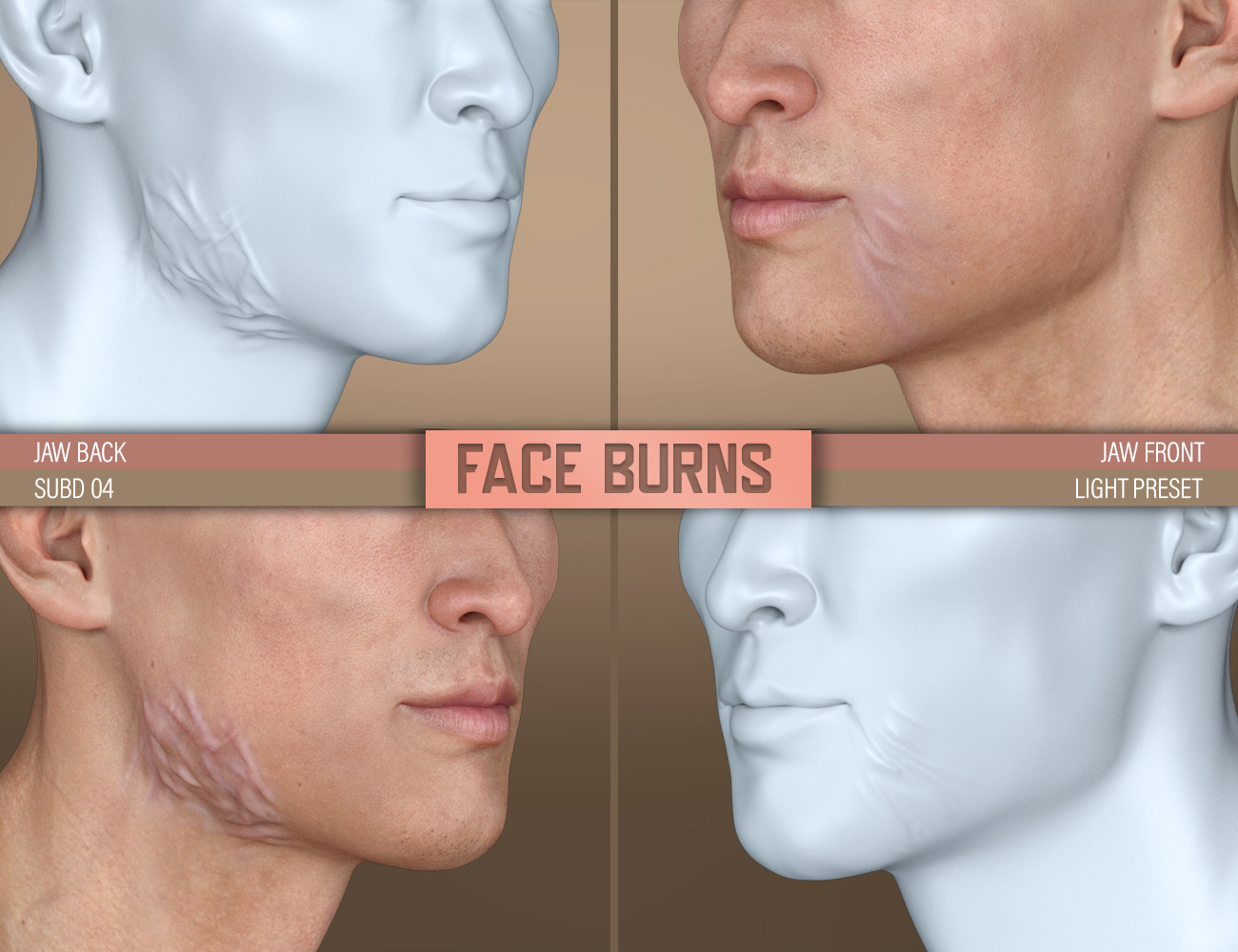 HD Face Burns for Genesis 8 Males | Daz 3D
