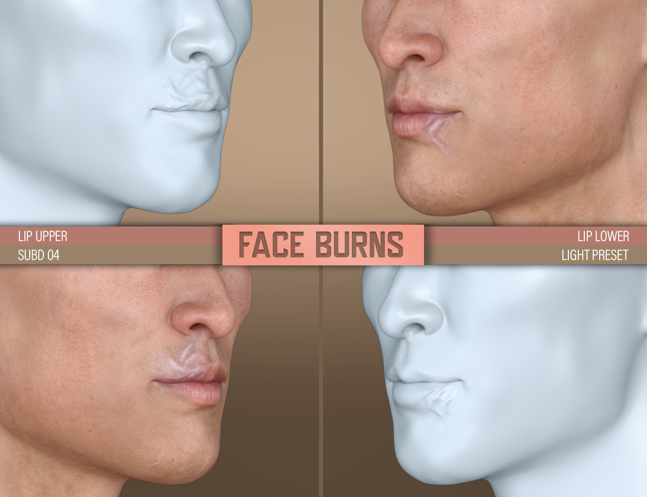 HD Face Burns for Genesis 8 Males | Daz 3D