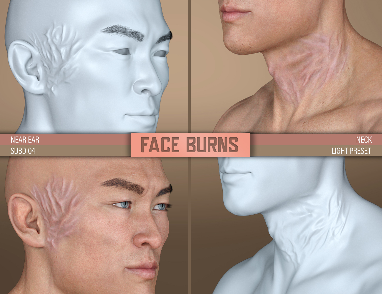 HD Face Burns for Genesis 8 Males | Daz 3D