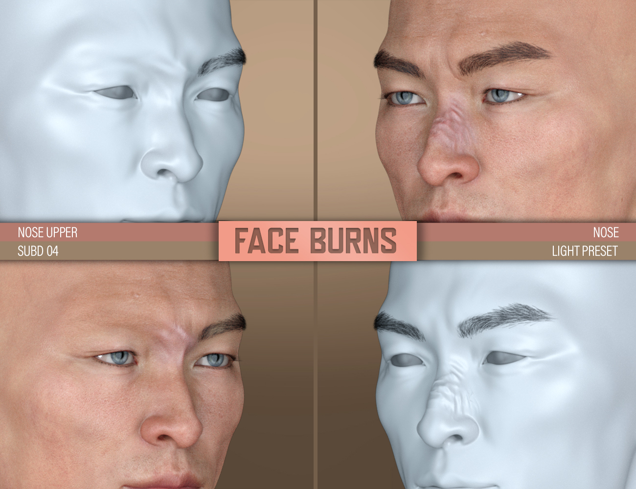 HD Face Burns for Genesis 8 Males | Daz 3D