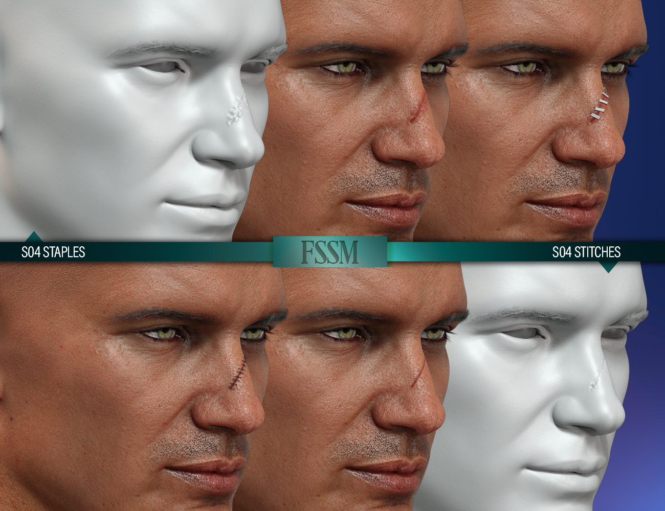 HD Face Staples and Stitches for Genesis 8 Males | Daz 3D