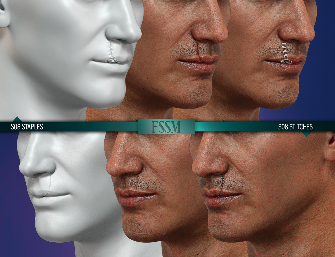 HD Face Staples and Stitches for Genesis 8 Males | Daz 3D