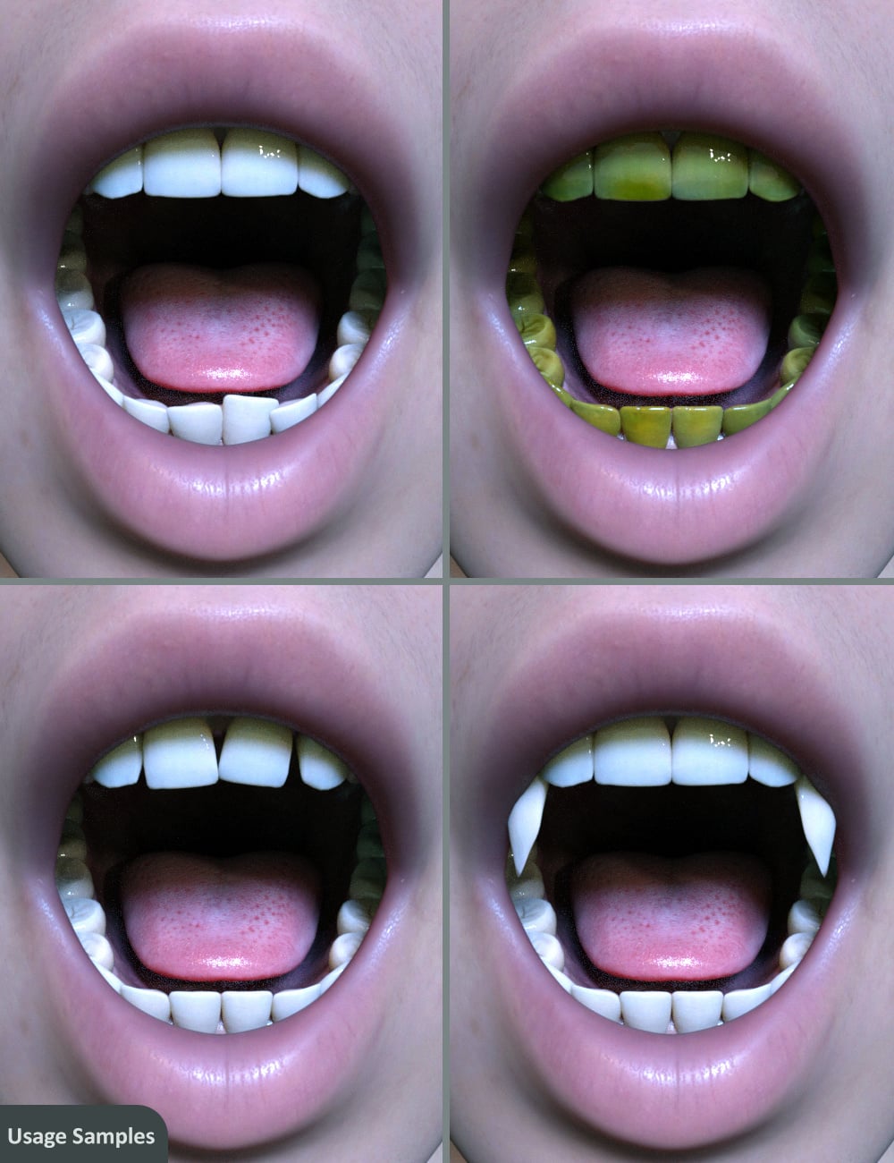 Easy Teeth for Genesis 9 | Daz 3D