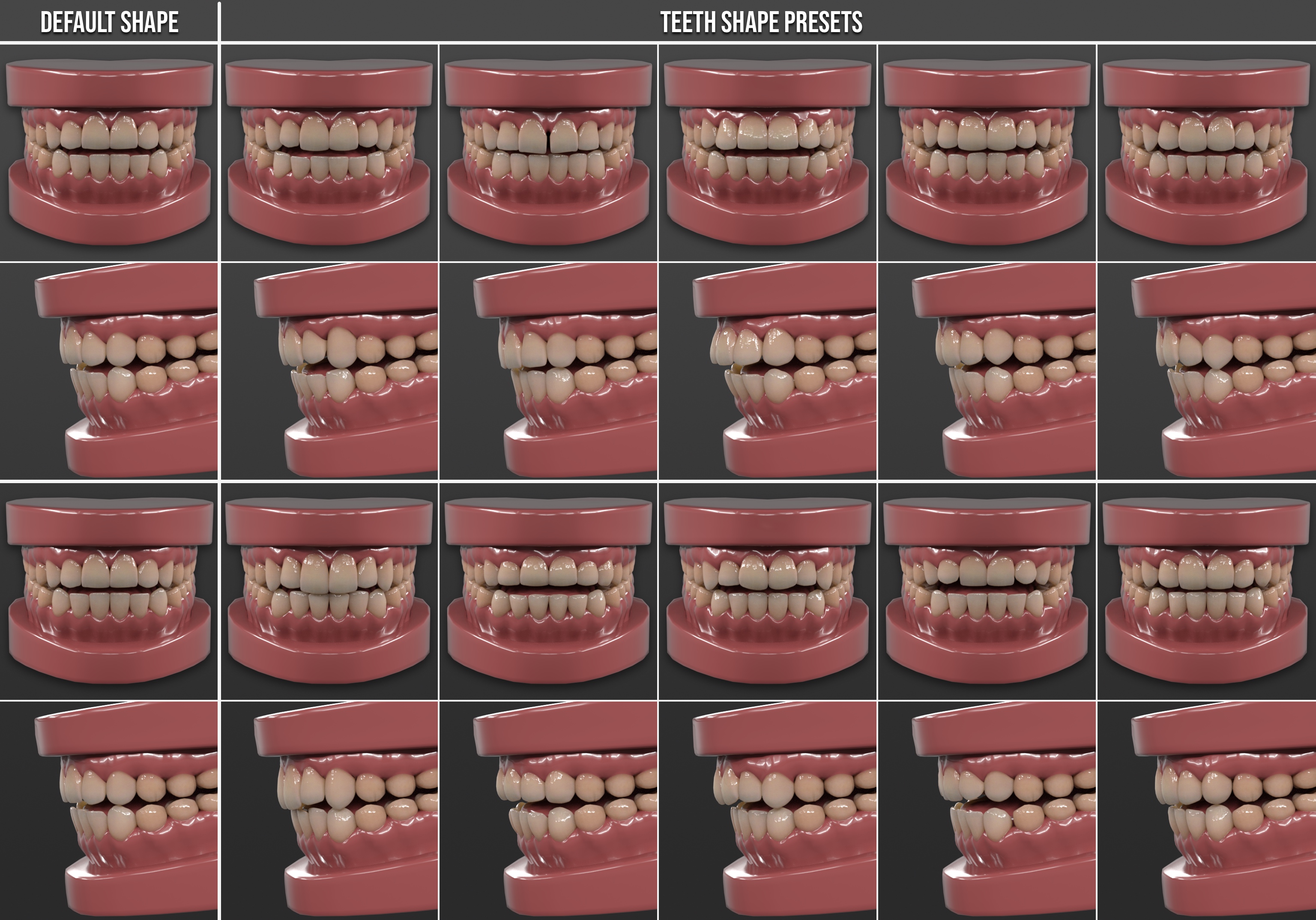 NG Build Your Own Smile for Genesis 9 - Dental Work | Daz 3D
