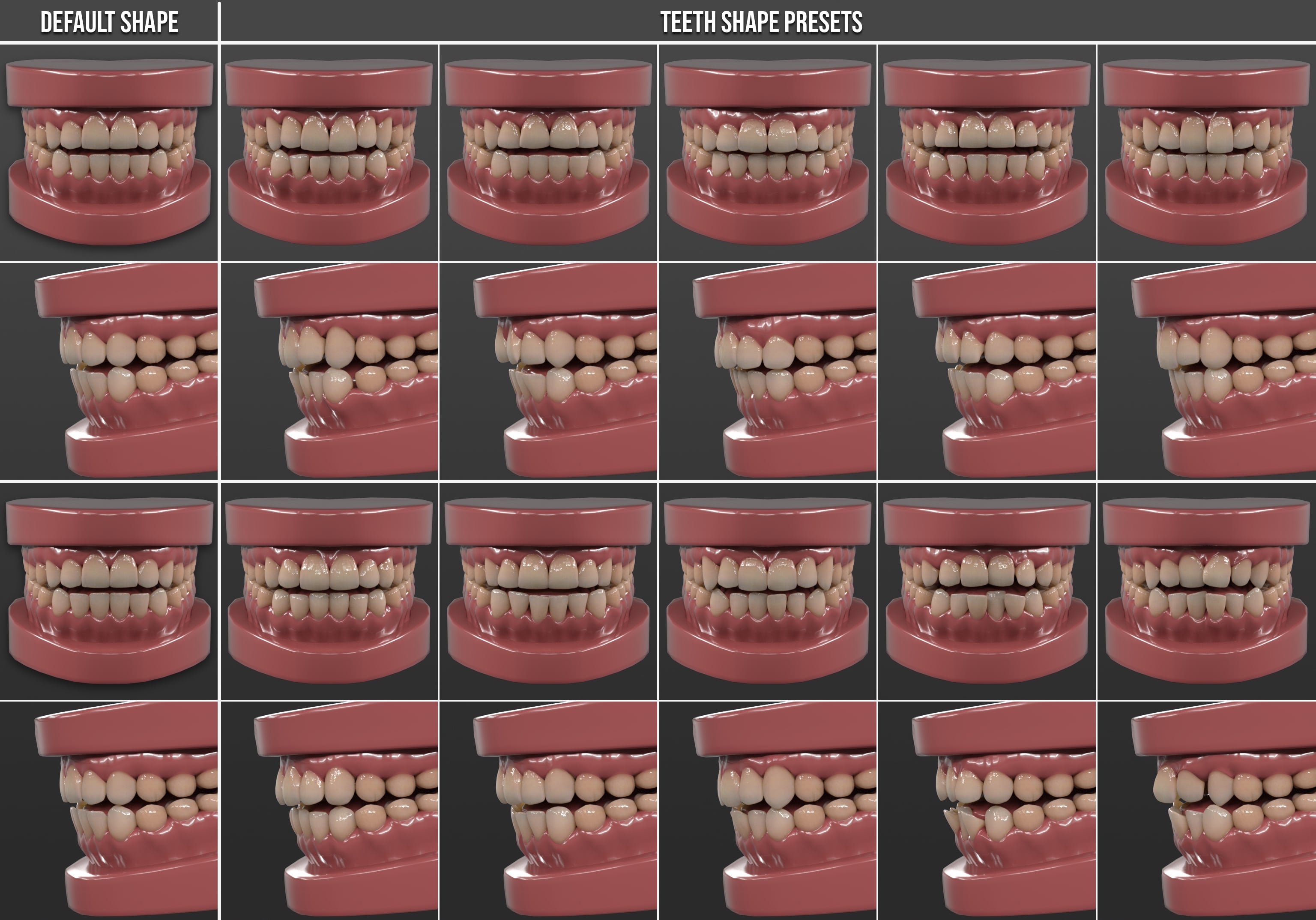 NG Build Your Own Smile for Genesis 9 - Dental Work | Daz 3D