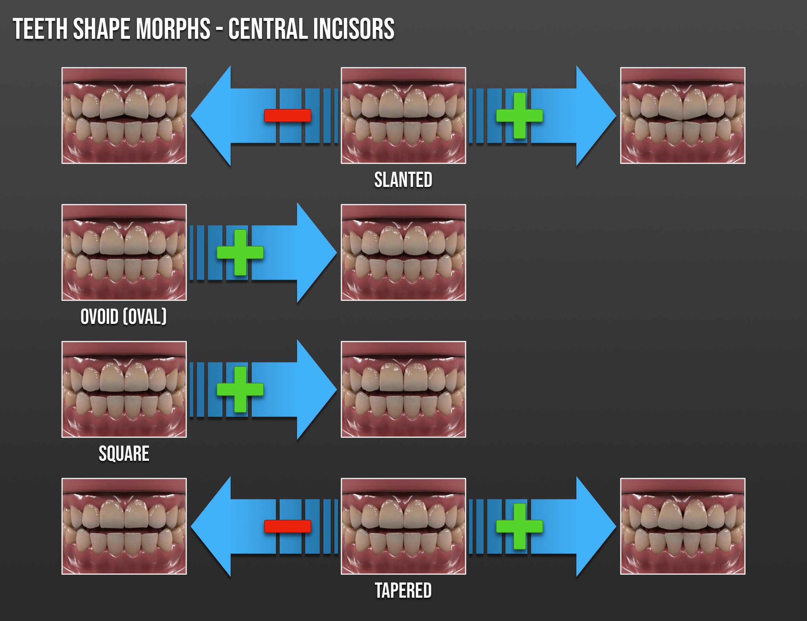 NG Build Your Own Smile for Genesis 9 - Dental Work | Daz 3D